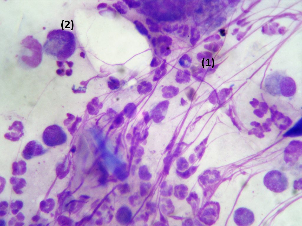 Un cas de furonculose pyotraumatique - Dr. Estelle BUENDIA ...